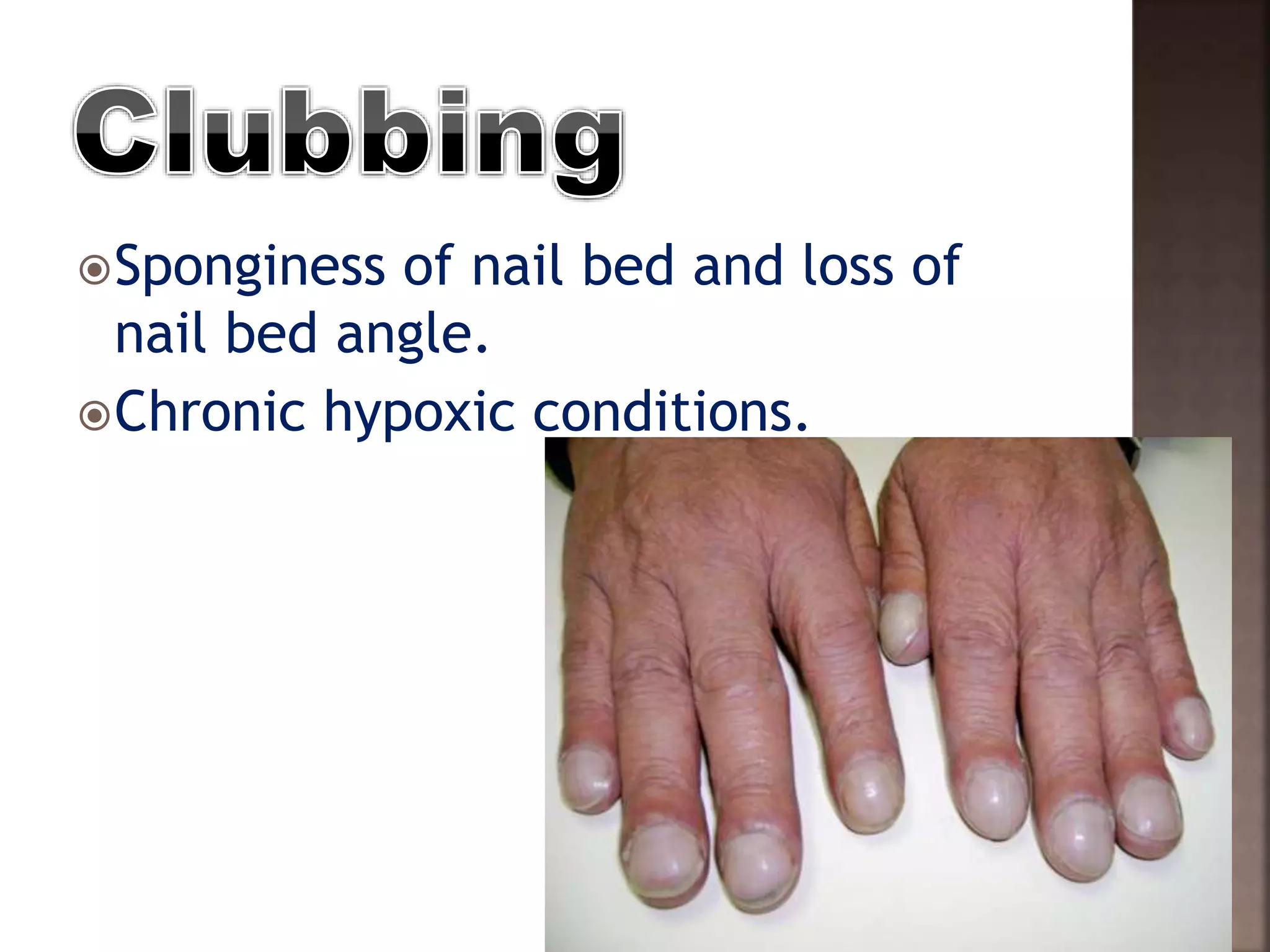 pulmonary assessment for nurses | PPTX