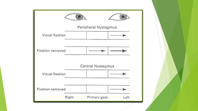 Assessment of vestibular system | PPTX