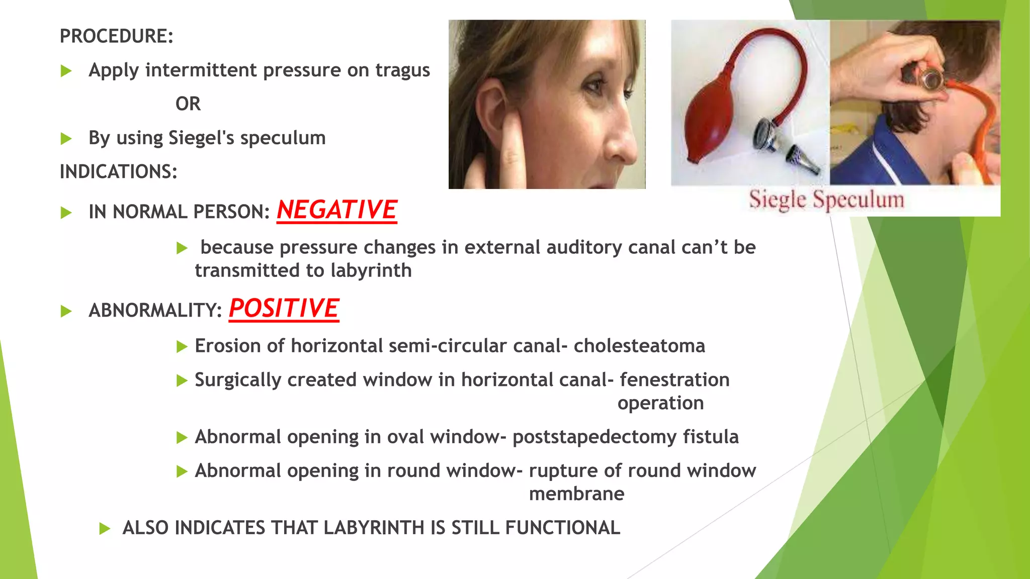 Assessments of vestibular system | PPTX