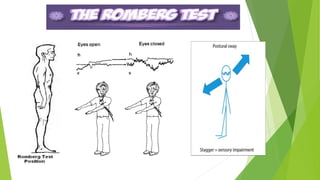 Assessments of vestibular system | PPTX