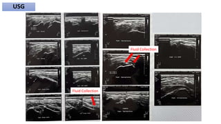 Assessment Sport Injury 16.08.22 (Nunung, Bertian, Nadhief, Andini).ppt
