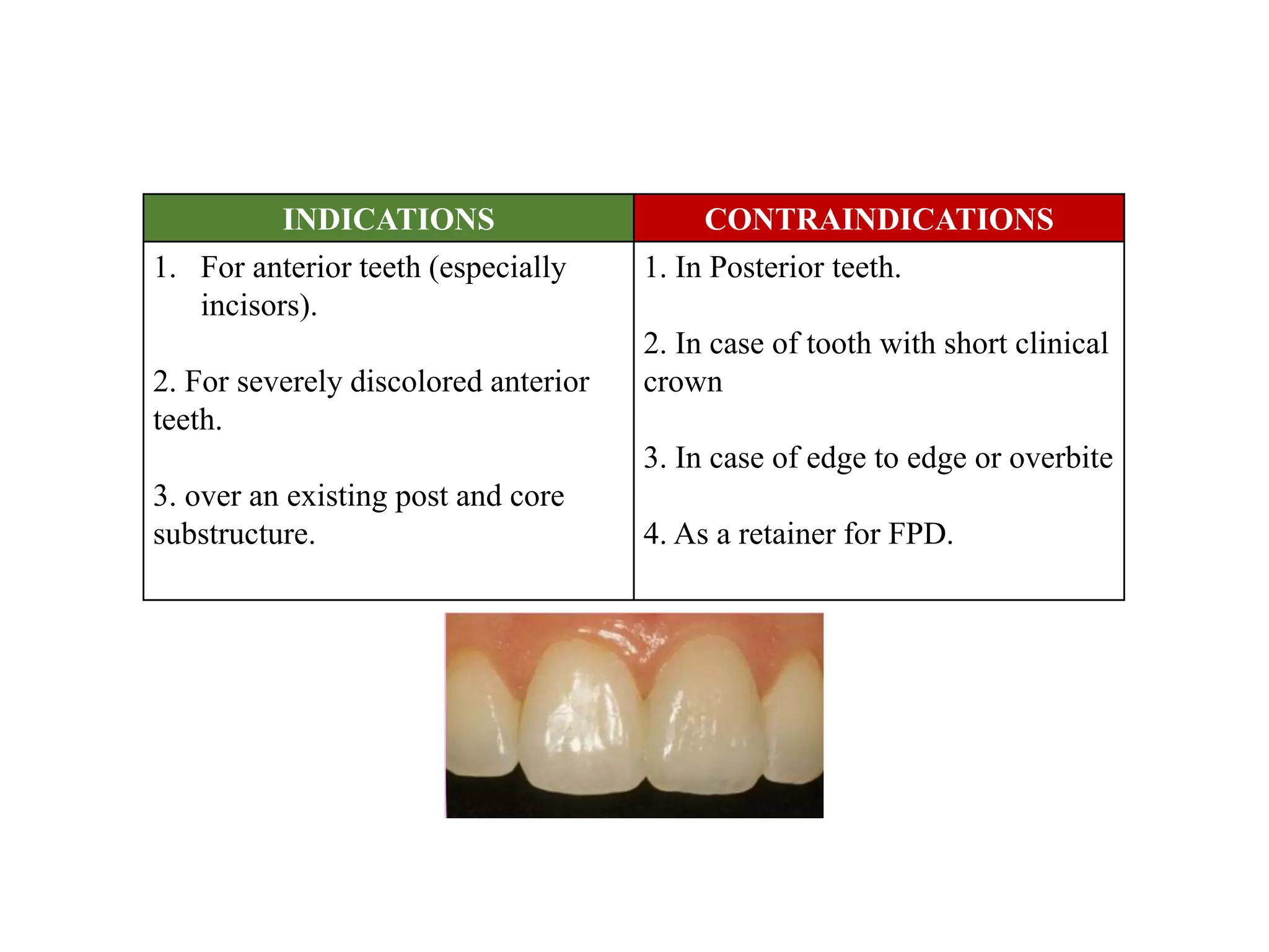 Retainer in FPD | PPTX