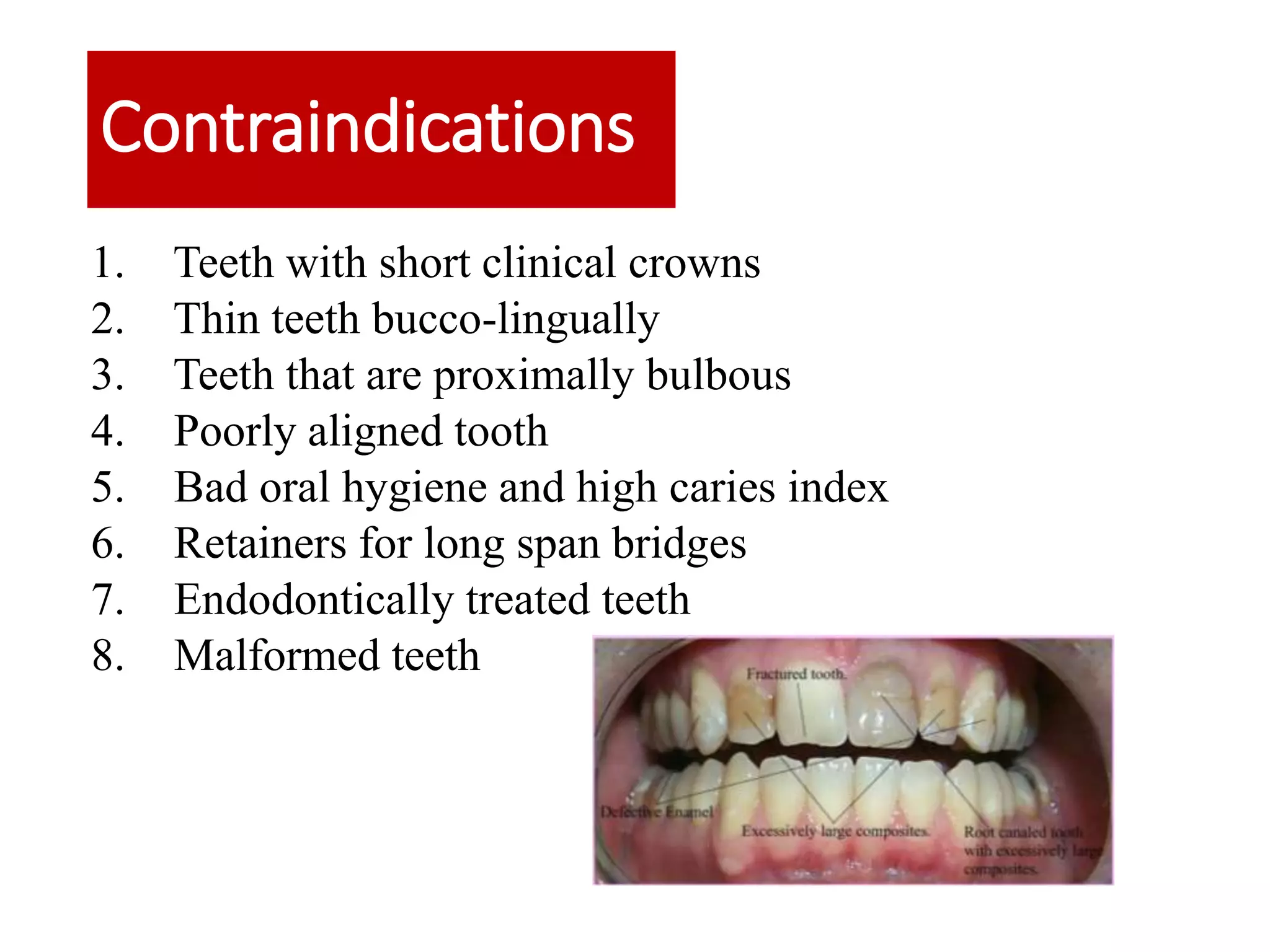 Retainer in FPD | PPTX