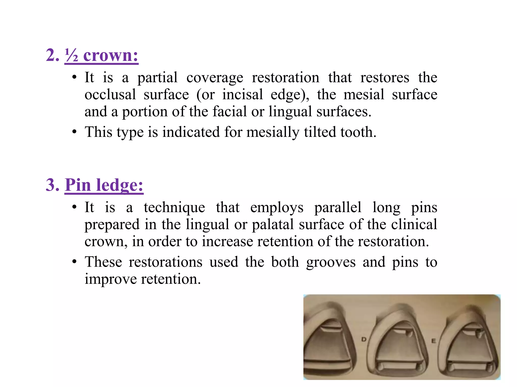 Retainer in FPD | PPTX