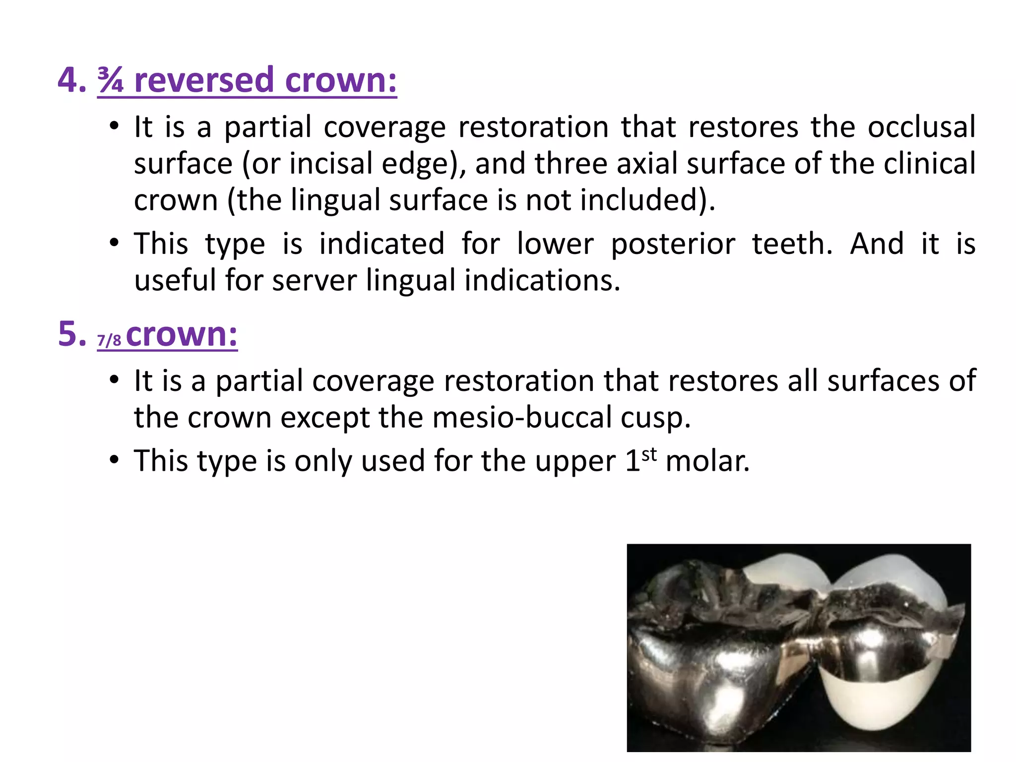 Retainer in FPD | PPTX