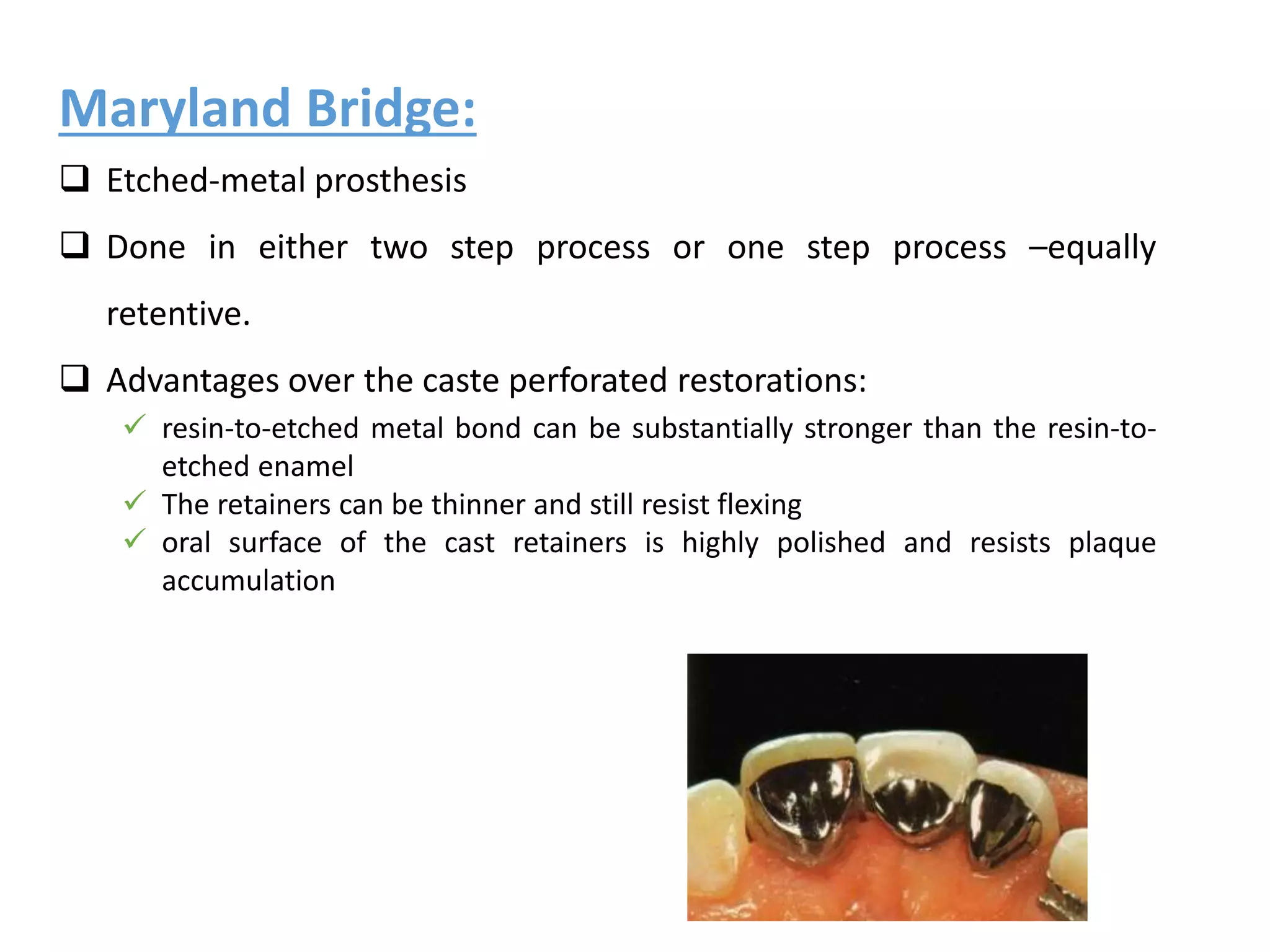 Retainer in FPD | PPTX