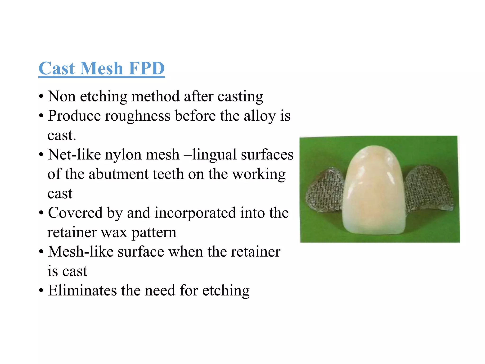 Retainer in FPD | PPTX