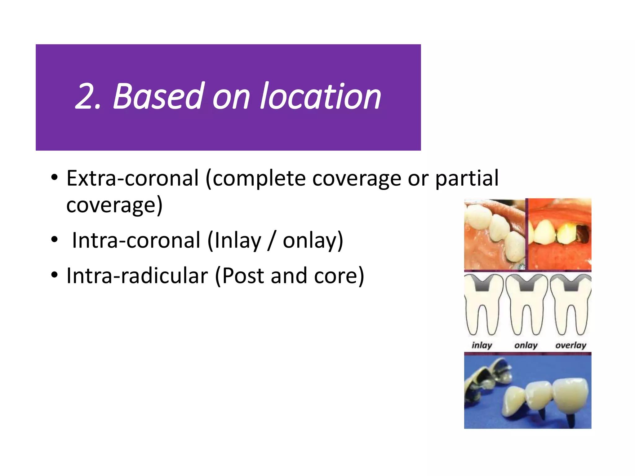 Retainer in FPD | PPTX