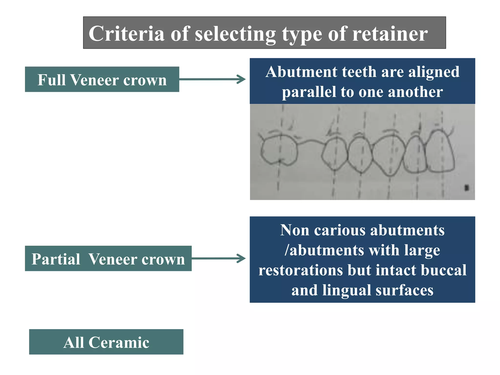 Retainer in FPD | PPTX