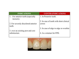 Retainer in FPD | PPTX