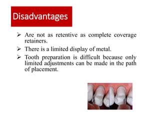 Retainer in FPD | PPTX