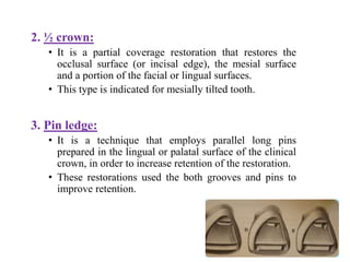 Retainer in FPD | PPTX