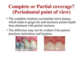 Retainer in FPD | PPTX