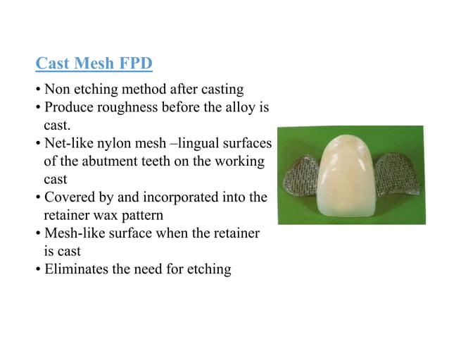 Retainer in FPD | PPTX | Oral care | Personal Care