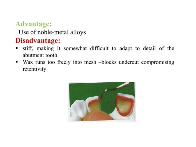 Retainer in FPD | PPTX | Oral care | Personal Care