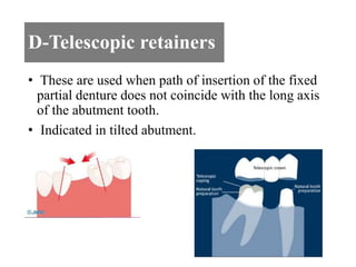 Retainer in FPD | PPTX