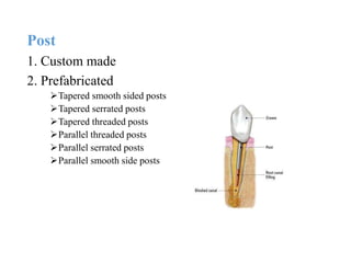 Retainer in FPD | PPTX