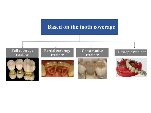 Retainer in FPD | PPTX | Oral care | Personal Care
