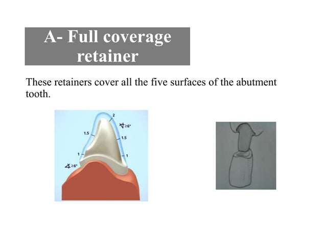 Retainer in FPD | PPTX | Oral care | Personal Care