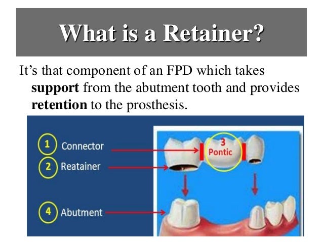 Retainer in FPD