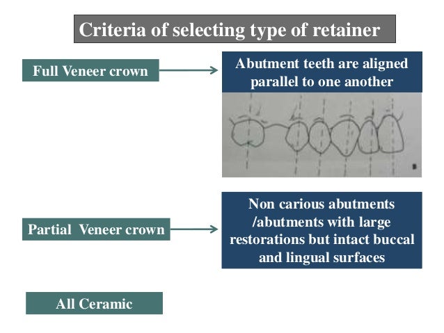 Retainer In Fpd