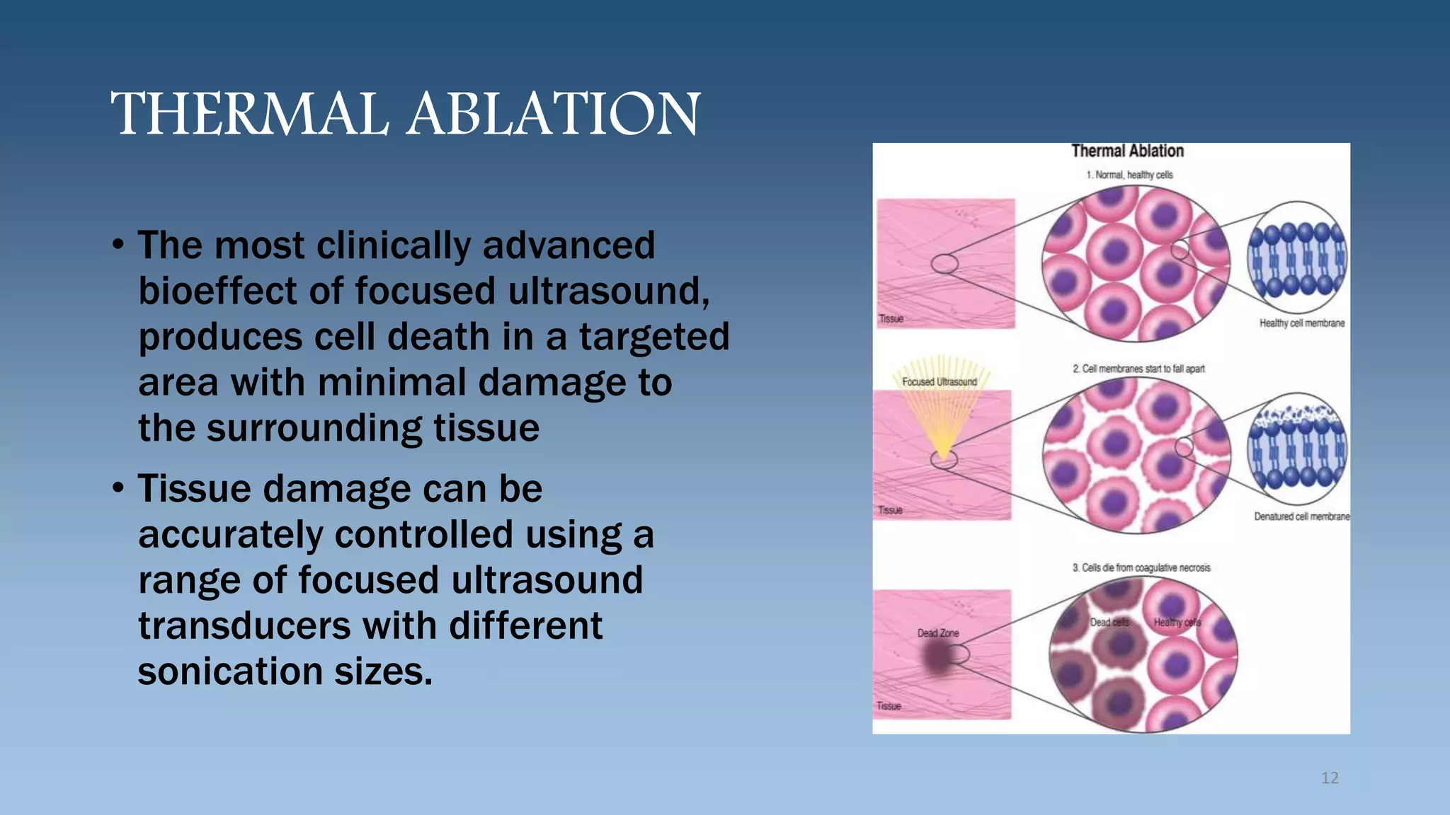 Ultrasound effects | PPTX
