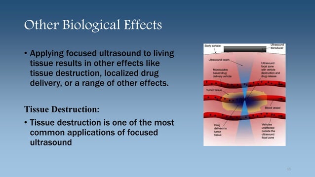 Ultrasound effects | PPTX