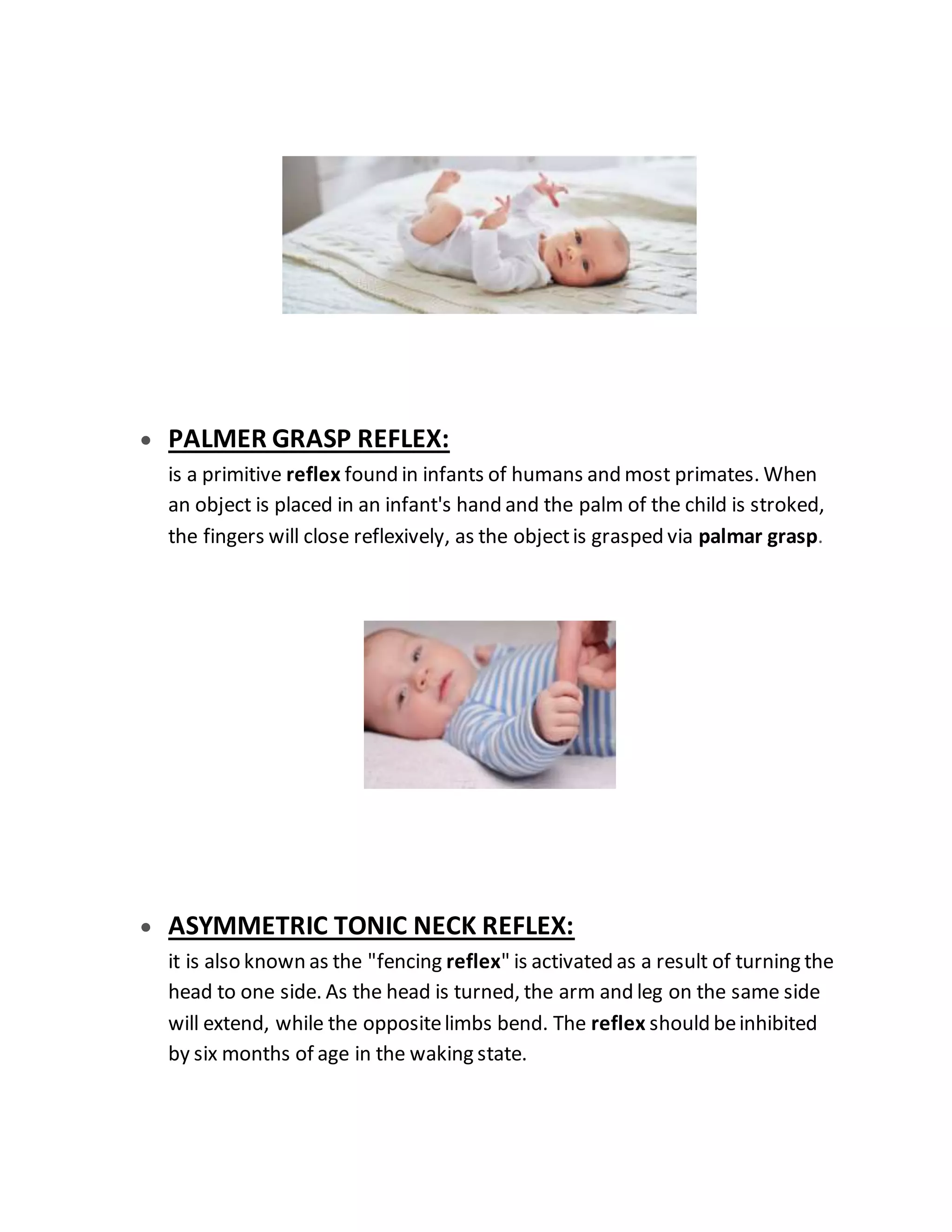 Primitive Reflexes | DOCX