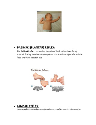 Primitive Reflexes | DOCX