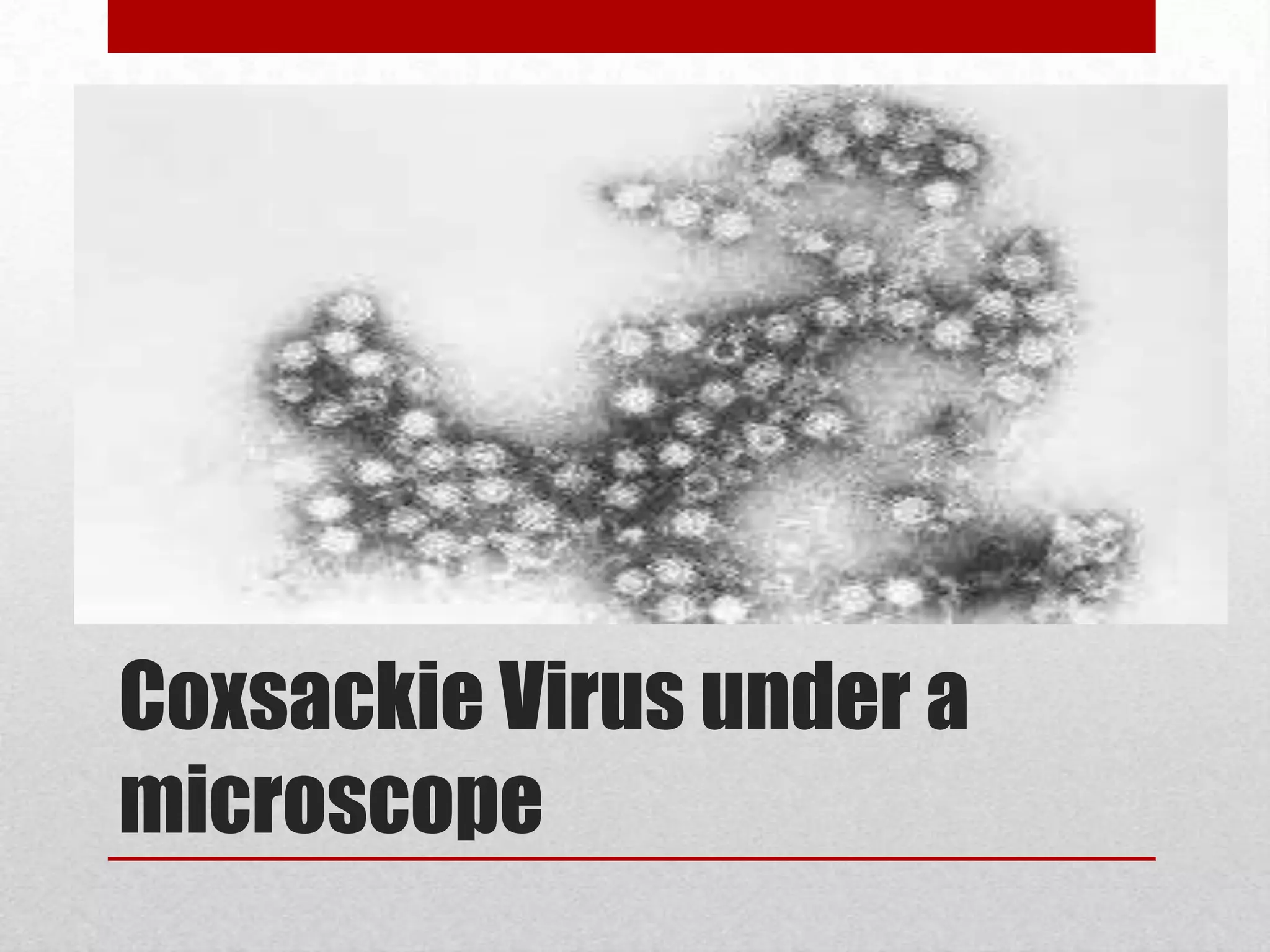 Assignment 11 (germ project) | PPTX | Infectious Diseases | Diseases ...