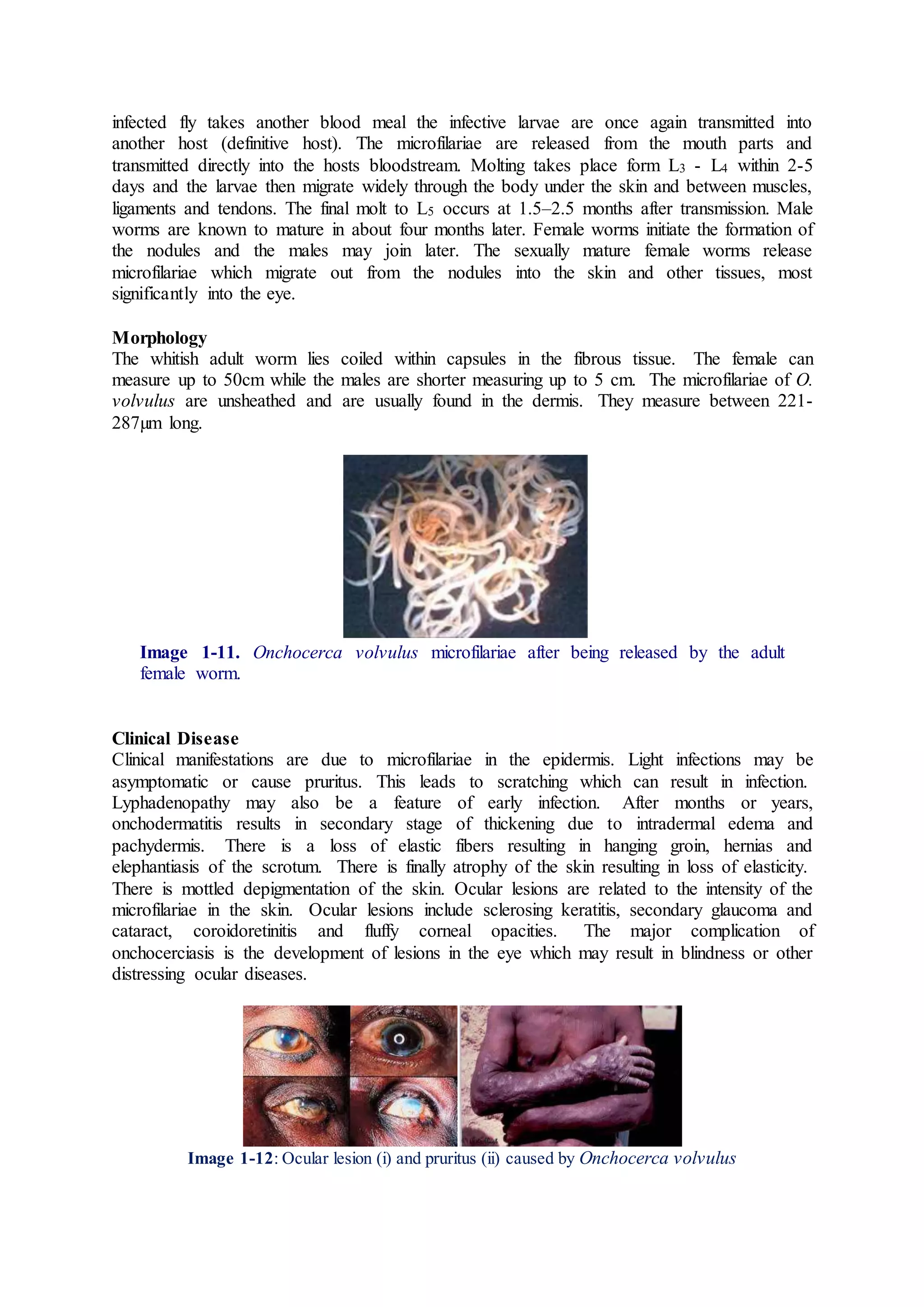 Classification of Microfilaria | DOCX