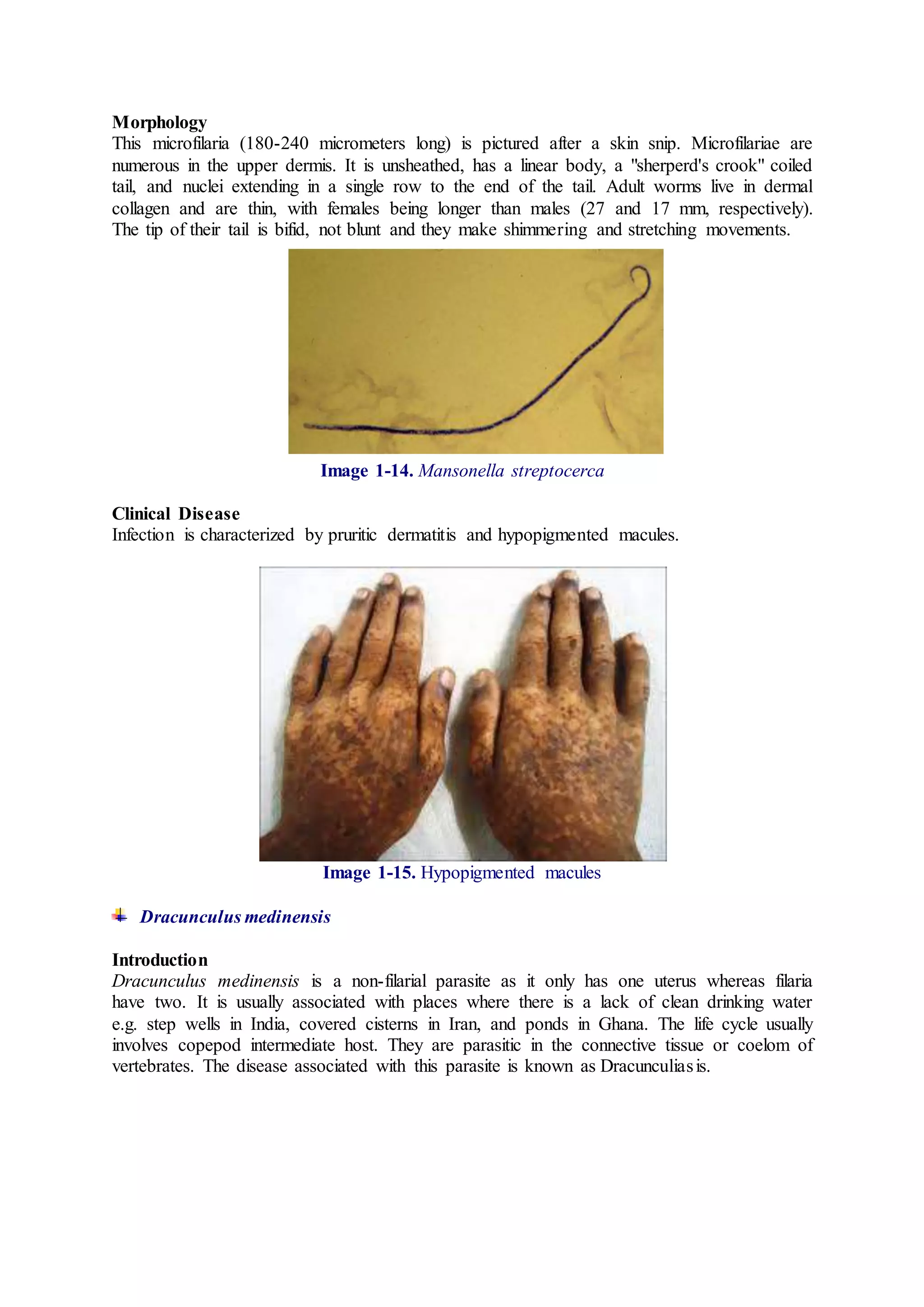 Classification of Microfilaria | DOCX