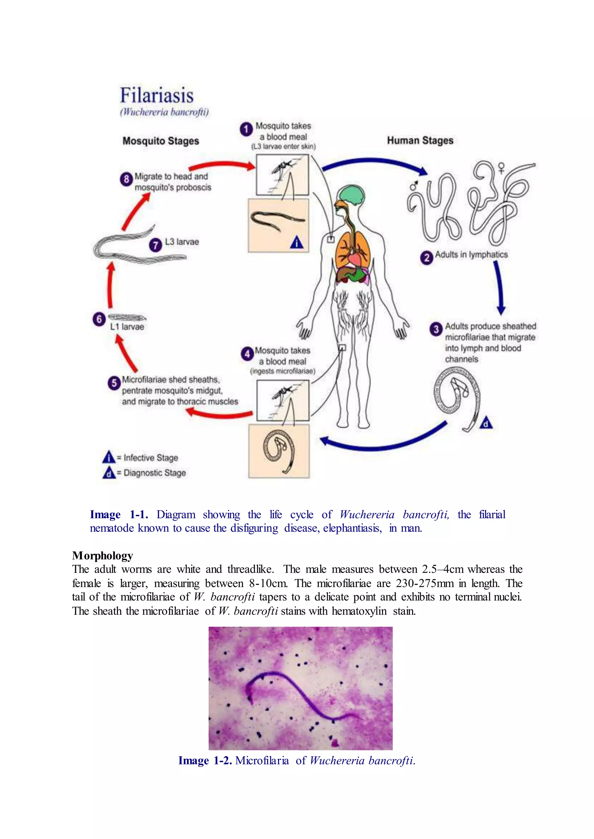 Classification of Microfilaria | DOCX