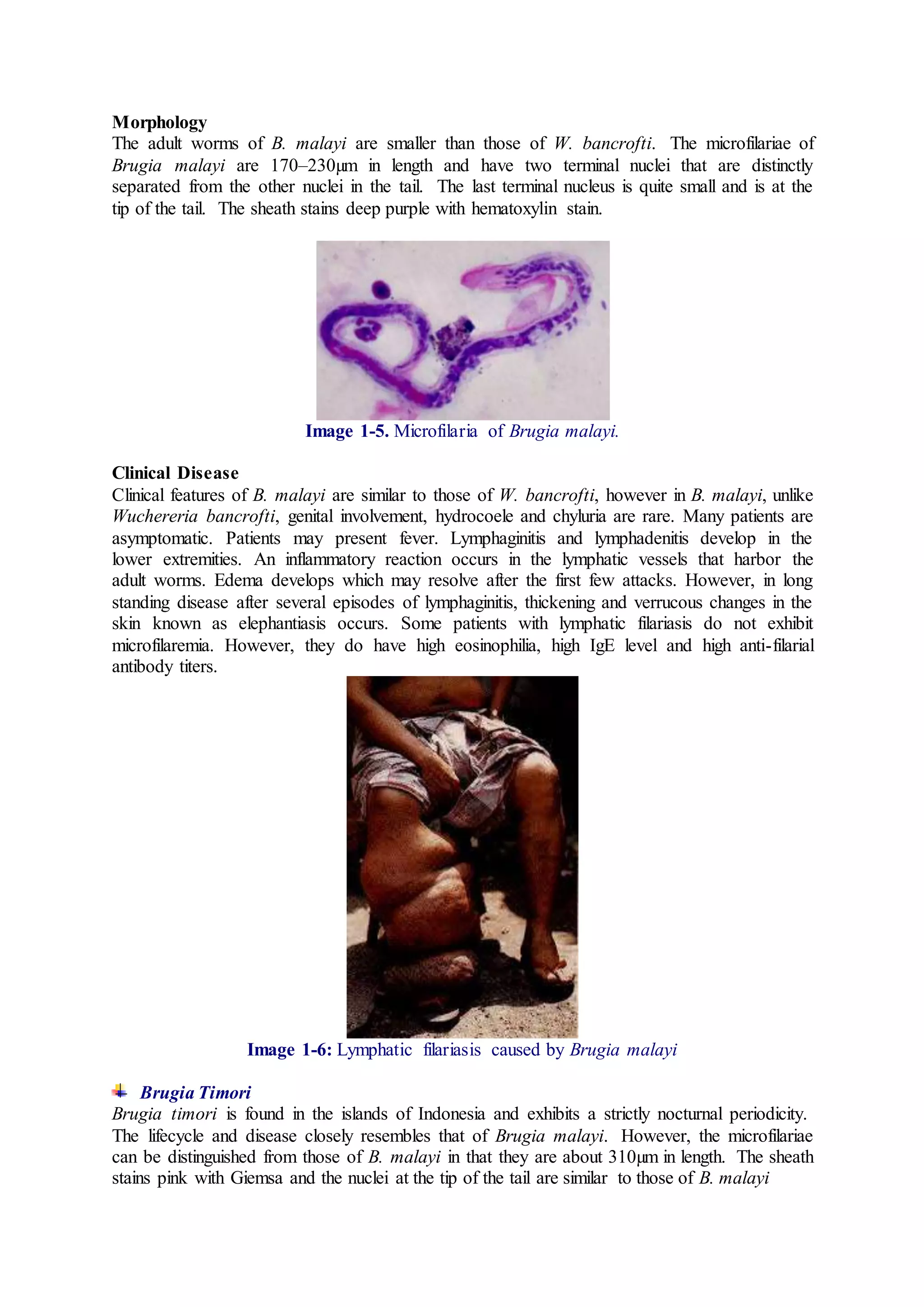 Classification of Microfilaria | DOCX