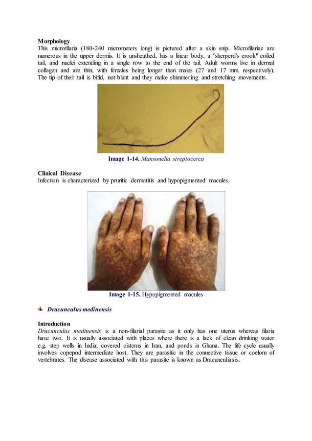 Classification of Microfilaria | DOCX | Infectious Diseases | Diseases ...