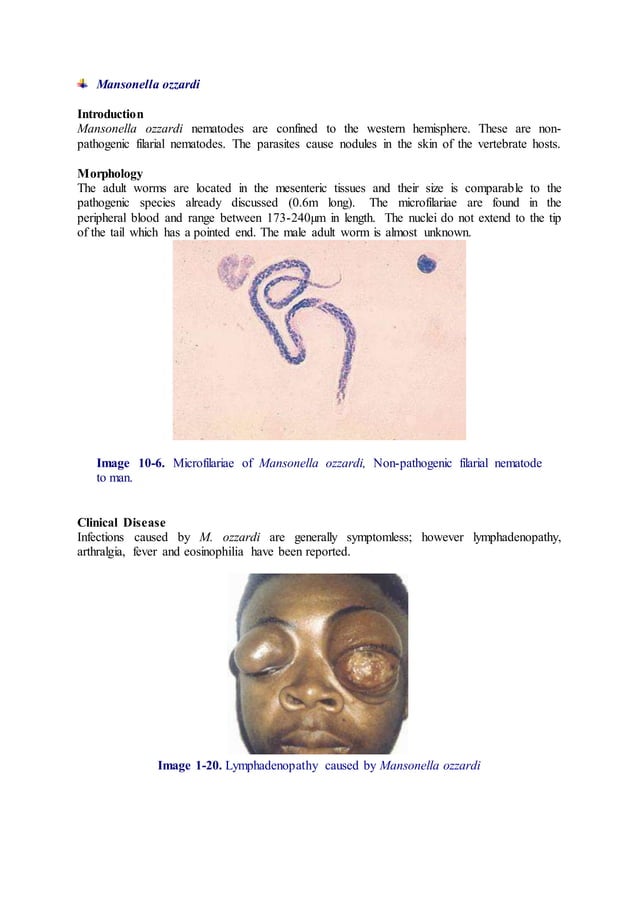 Classification of Microfilaria | DOCX | Infectious Diseases | Diseases ...