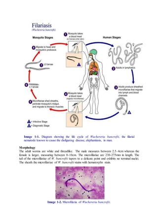 Classification of Microfilaria | DOCX