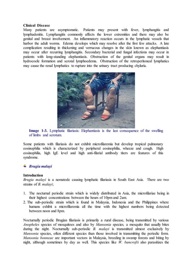 Classification of Microfilaria | DOCX | Infectious Diseases | Diseases ...
