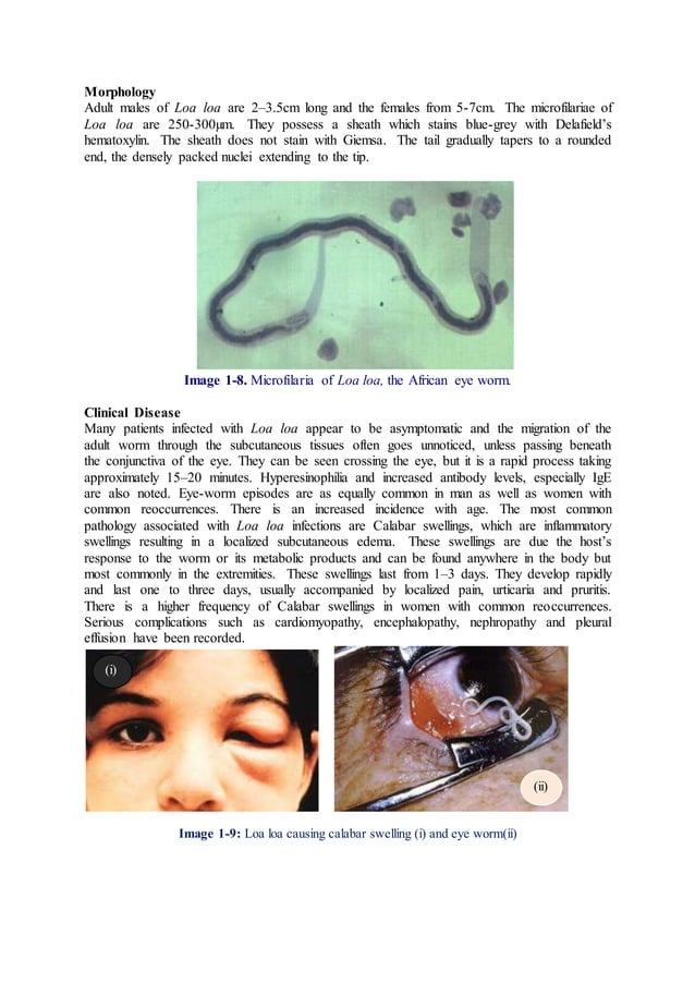 Classification of Microfilaria | DOCX | Infectious Diseases | Diseases ...