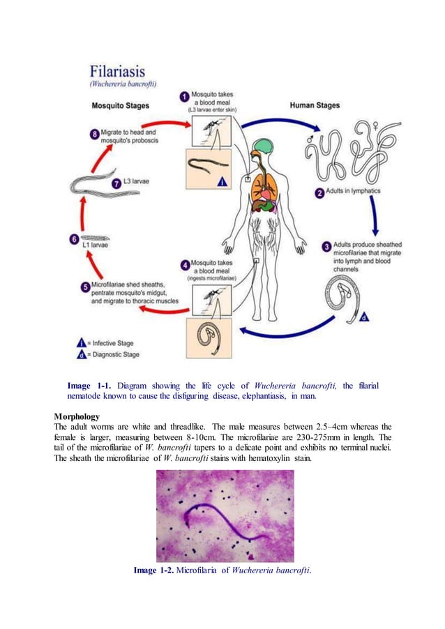 Classification of Microfilaria