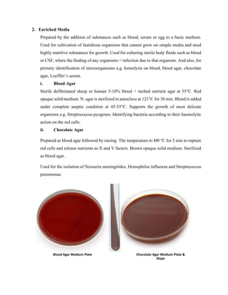 Bacterial Culture Media | PDF