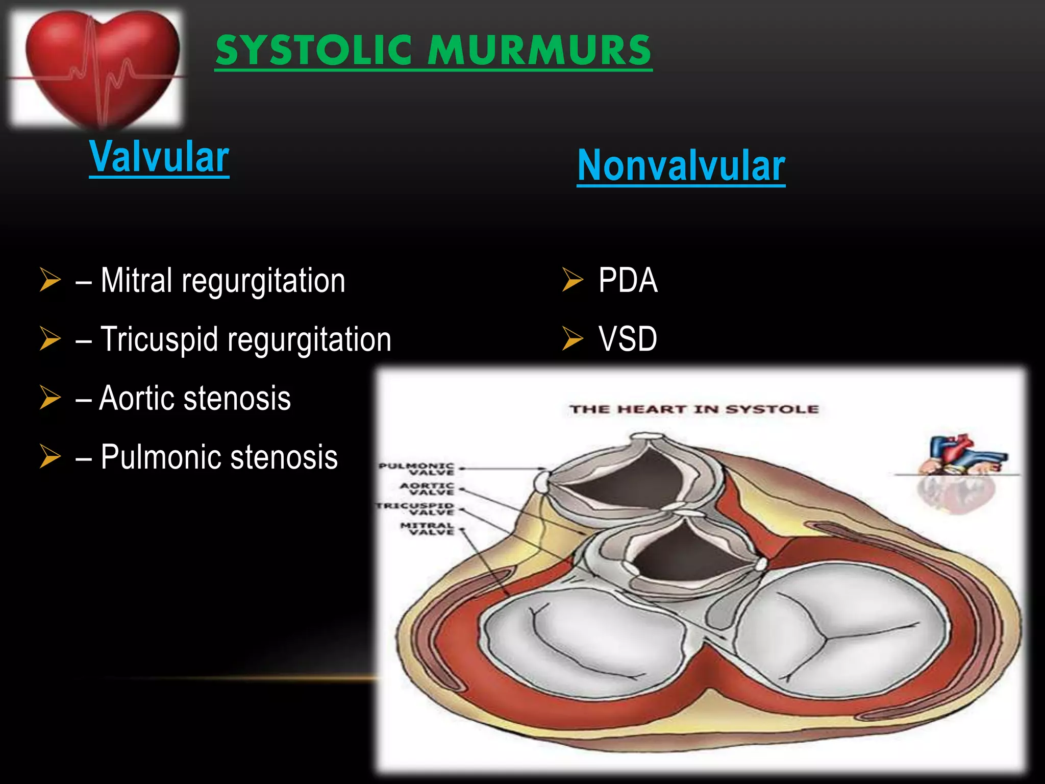 Heart Sounds and Murmurs | PPT