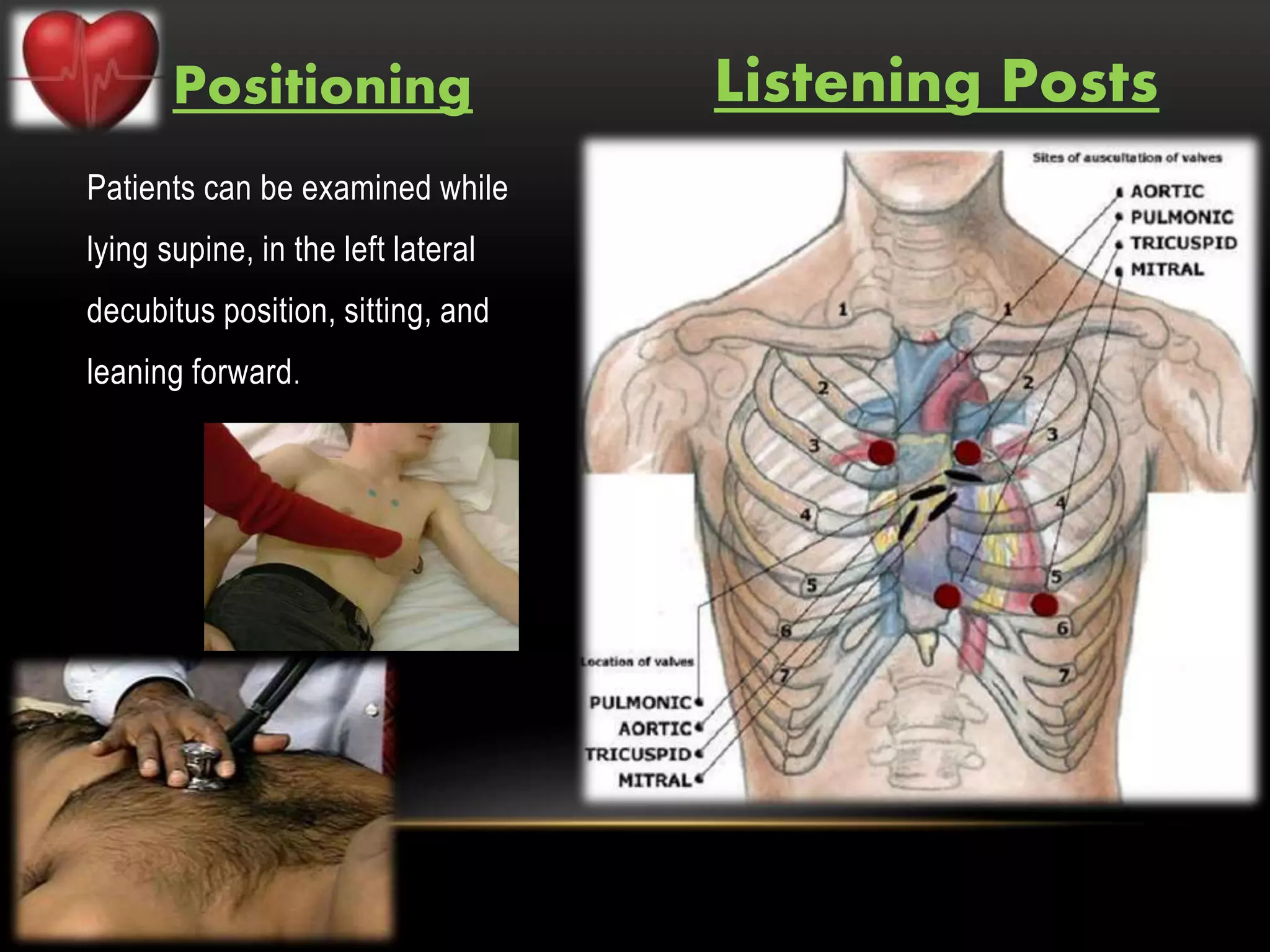 Heart Sounds and Murmurs | PPT