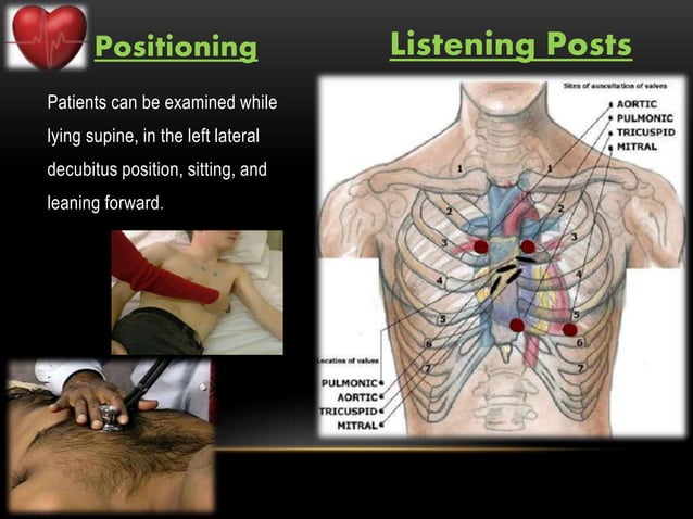 Heart Sounds and Murmurs | PPT