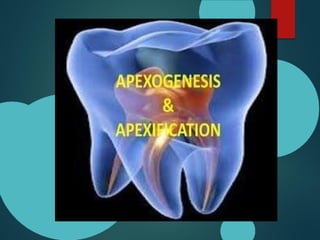ASSIGNMENT ON APEXOGENESIS AND APEXIFICATION.pptx