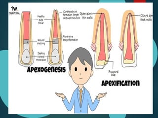 ASSIGNMENT ON APEXOGENESIS AND APEXIFICATION.pptx