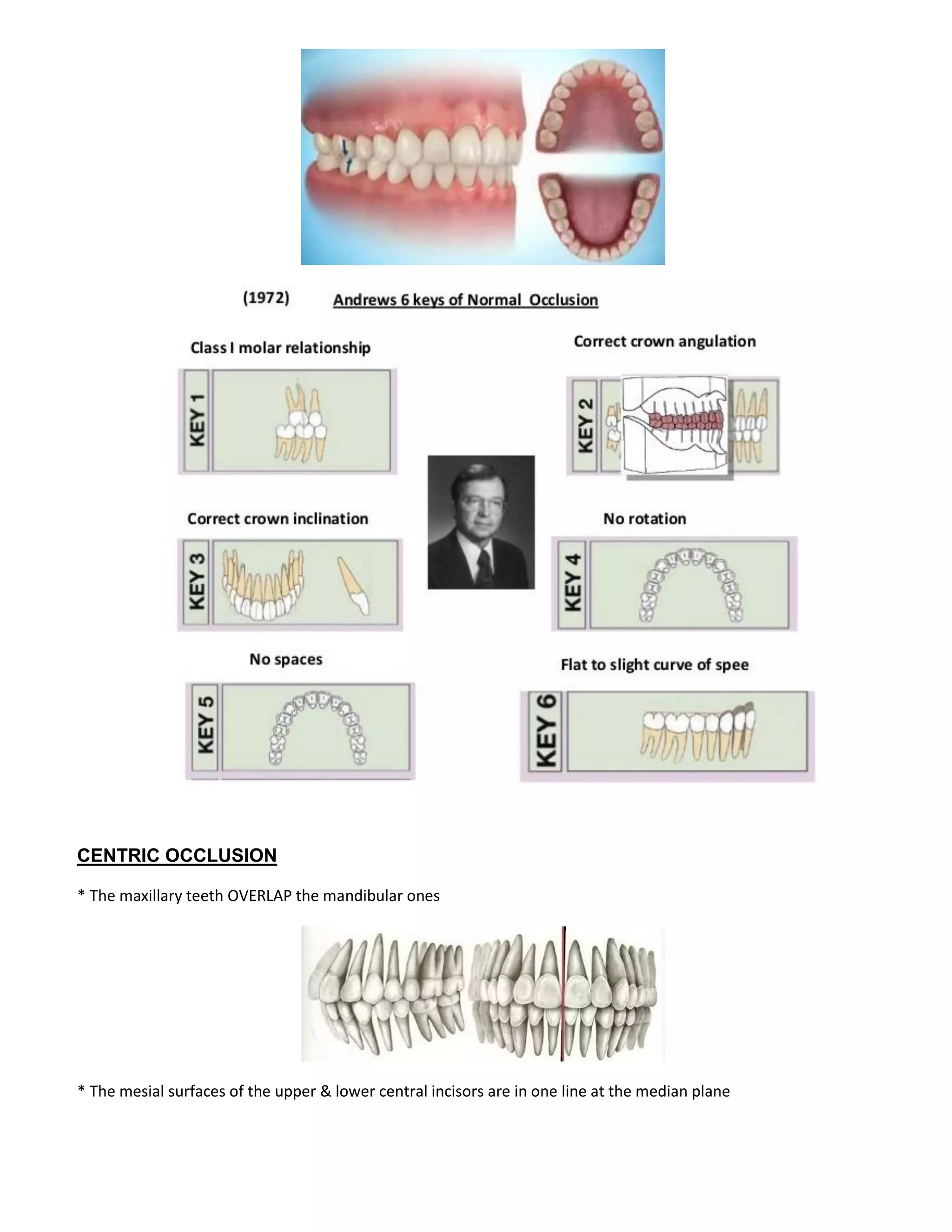occlusion | PDF