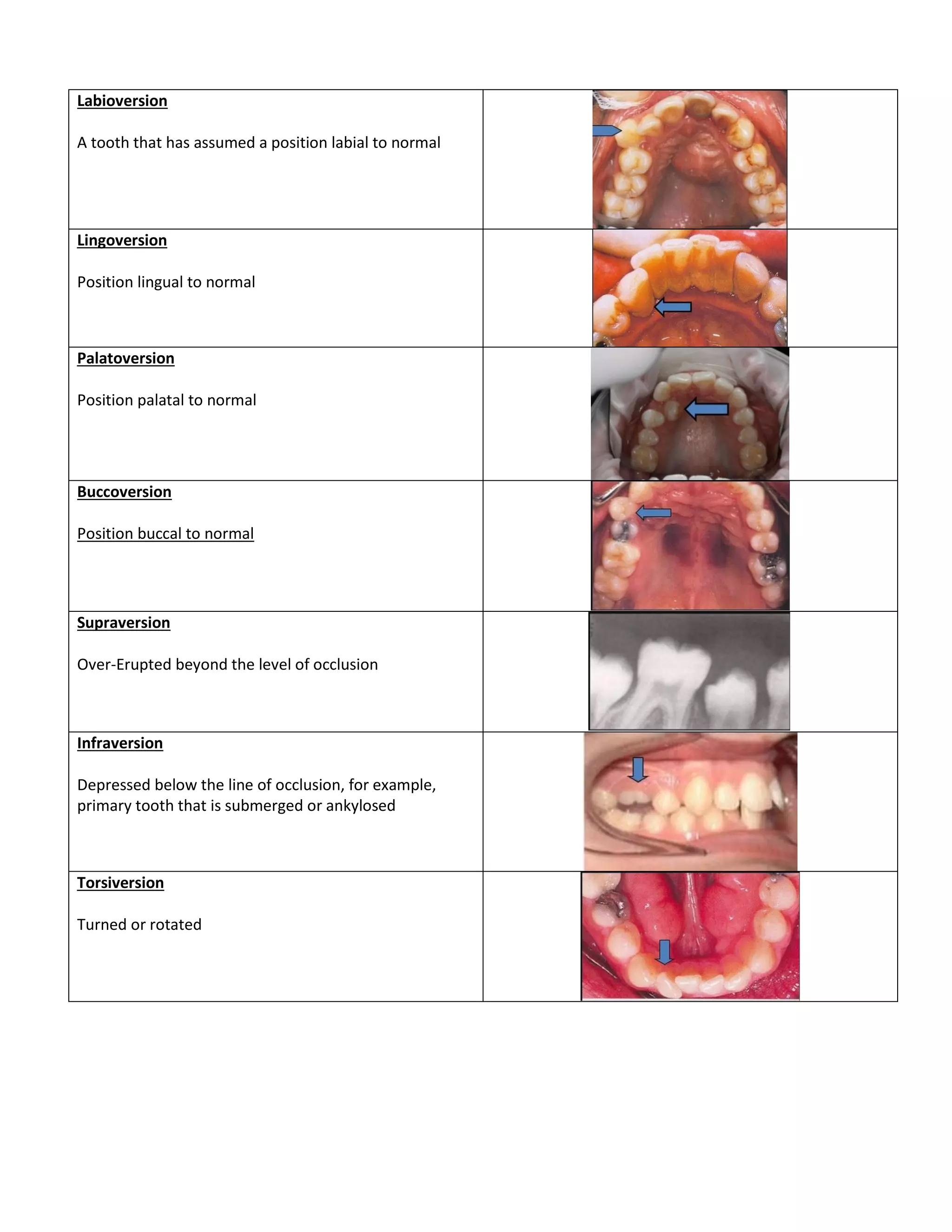 occlusion | PDF