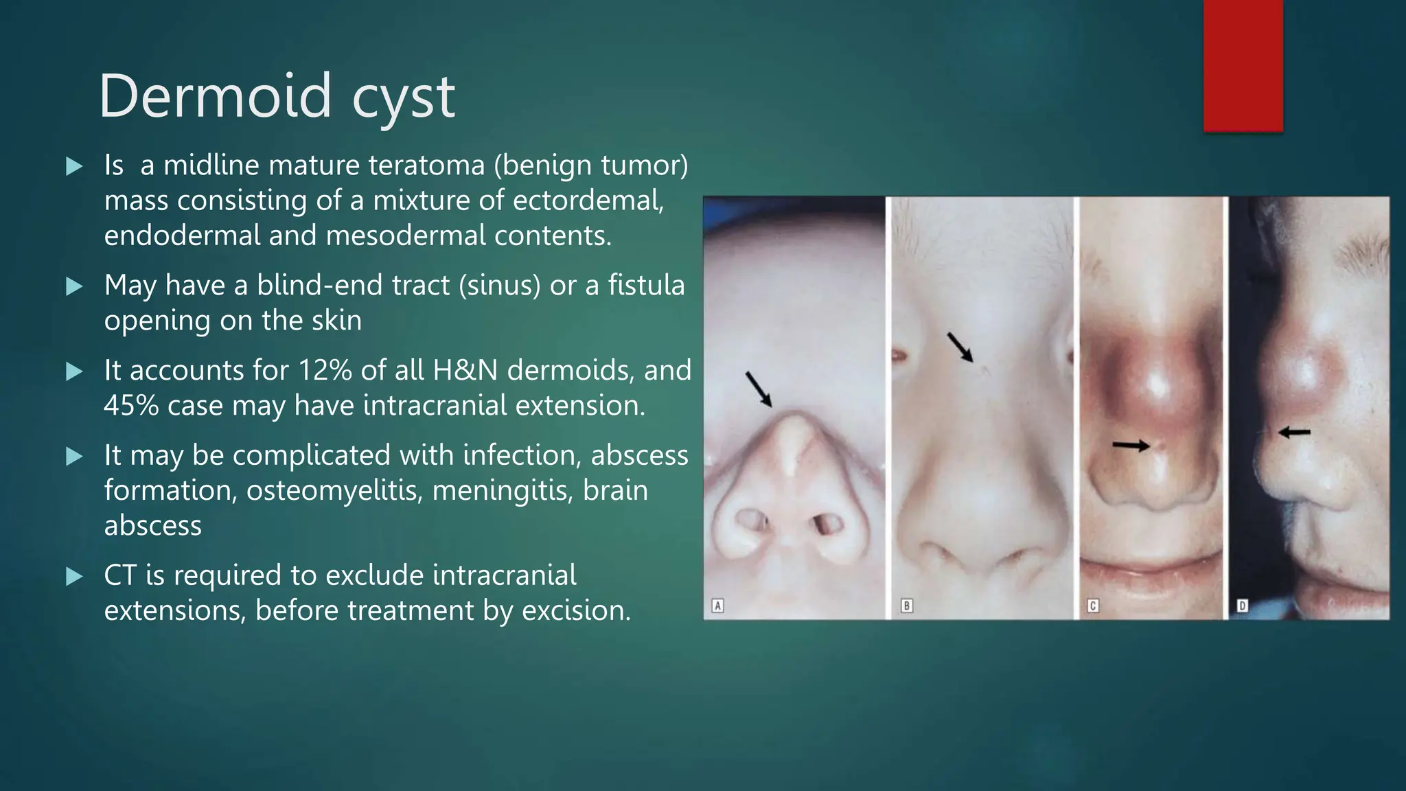 assignx_cong diseaseses_nose&pns_mashrab.pptxassignx_cong diseaseses ...