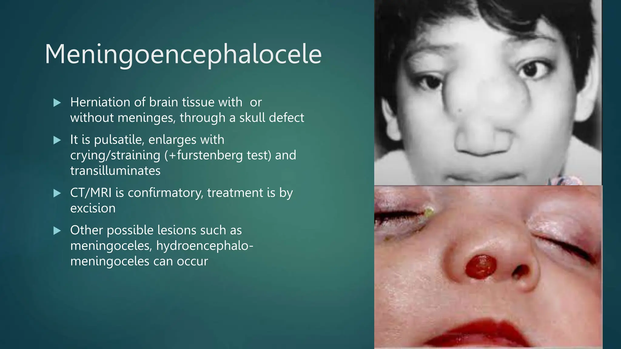 assignx_cong diseaseses_nose&pns_mashrab.pptxassignx_cong diseaseses ...